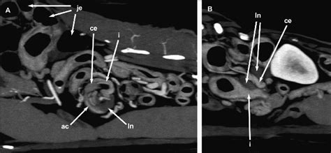 Sagittal A And Sagittal Oblique B Multiplanar Reformatted Download Scientific Diagram