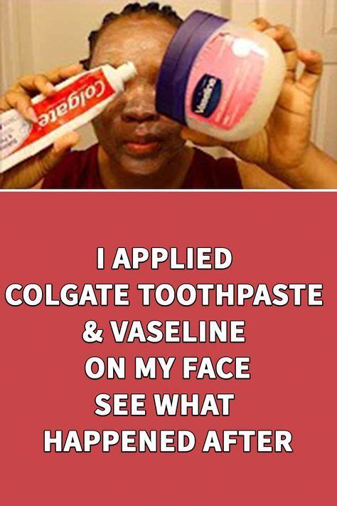 Natural Wrinkle Remedies The Face Artofit