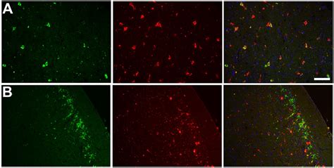 Comparison Of The In Vivo Induction And Transmission Of α Synuclein