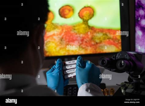 Blood Tests To Detect Sexually Transmitted Diseases Or STDs Hepatitis B And C Syphilis HIV