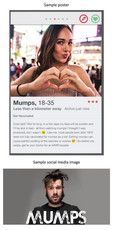 Controlling A Mumps Outbreak In A Young Adult Population Canadaca