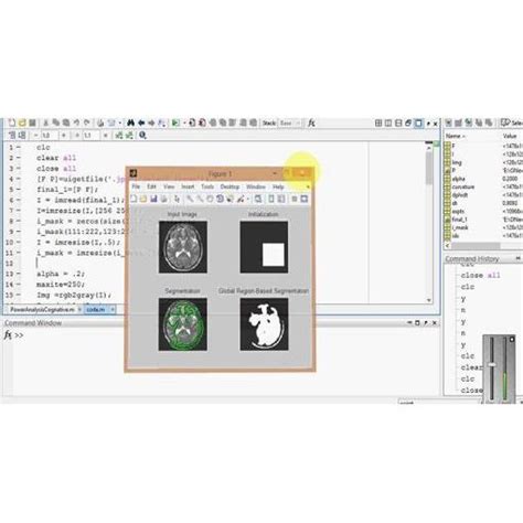 improved image segmentation using contour model classification