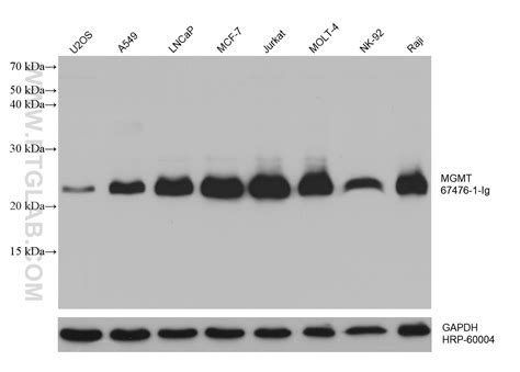 Mgmt Antibody 67476 1 Ig Proteintech 武汉三鹰生物技术有限公司