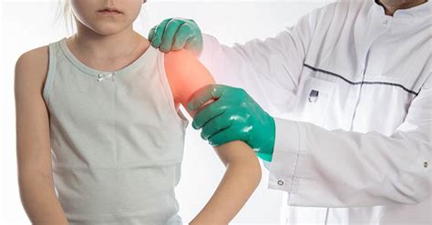 Pyomyositis A Challenging Diagnosis In Nontropical Countries