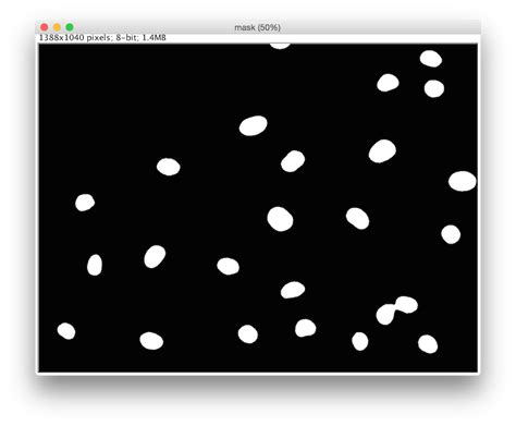 Segmentation In Fiji