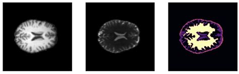 Learn To Discover On Linkedin Machinelearning Ai Ml Healthcareai Innovation Healthcare