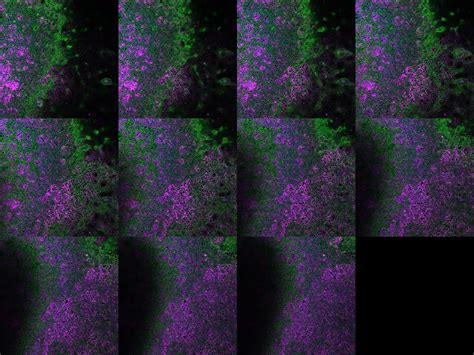 Oblique Slicer Generation In Imagej Image Analysis Image Sc Forum