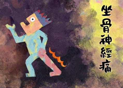 坐骨神經痛跟姿勢有關！6個緩解方法及預防關鍵｜家天使 找看護第一品牌