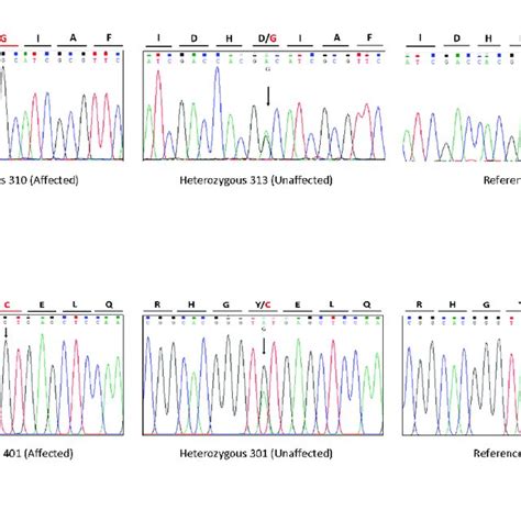Electropherograms Showing Causative Tpo Variants C719ag