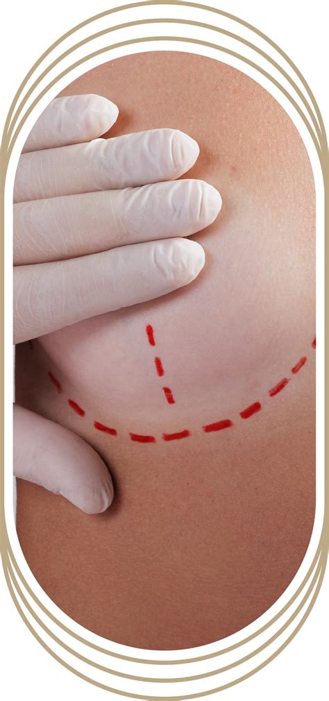 Fat Transfer To Breast Guste Plastic Surgery