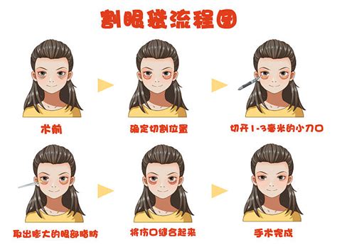 眼部 眼袋 眼袋手术 割眼袋 割眼袋手术过程去眼袋 祛眼袋 消除眼袋 眼袋怎么消除 割眼袋流程图