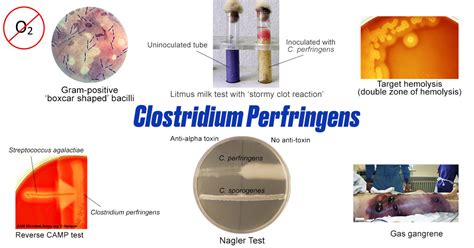 Disease Caused By Clostridium Perfringens Captions Beautiful