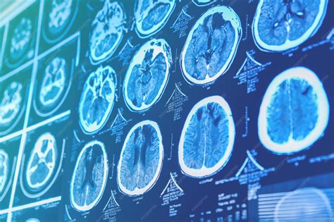 Premium Photo Closeup Of Ct Scan With Brain Medicine Science And