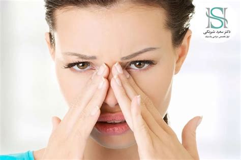 ورم نوک بینی بعد از عمل دکتر سعید شیرنگی