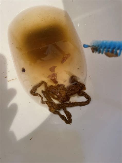 Rope Worm Or Intestinal Lining Rpoop