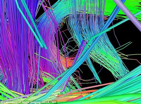 Human Brain Mapping Project Obama Erotecno