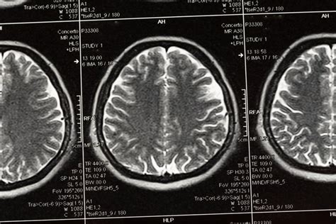What Happens To Your Brain During Sex Best Health Magazine