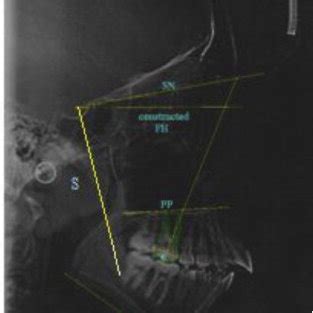 Constructed Lines And The Centroid Point Download Scientific Diagram