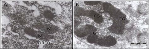 Electron Micrographs A Of The Cytoplasm Of The Motor Neuron Cell In