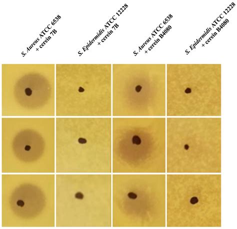 Selective Bacteriocins A Promising Treatment For Staphylococcus Aureus