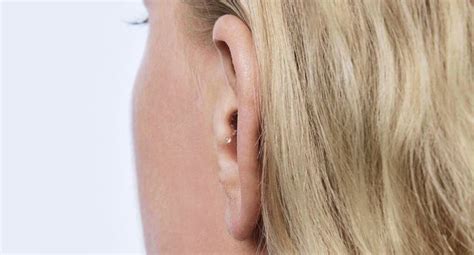 Signia Active IX Das revolutionäre Hörgerät im Earbud Design