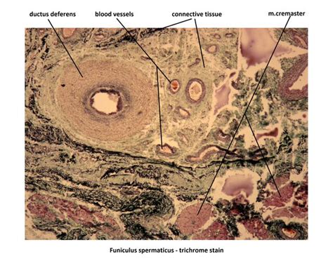 Funiculus Spermaticus Image Wikilectures