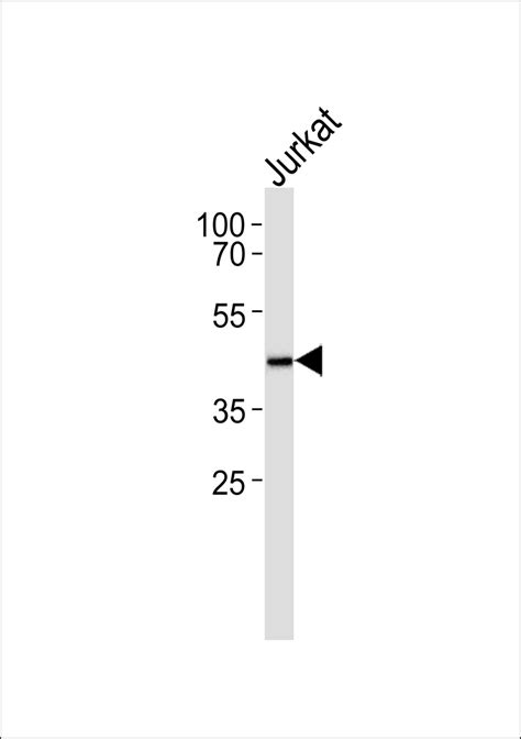 Pex10 Antibody Amm07092g Leading Biology Leading Biology Inc