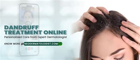 Dandruff Treatment By Dermatologist Causes Shampoo And Tablets