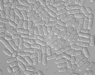 Plasmid Extraction From Yeast
