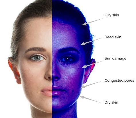 What Is Skin Analysis Why Is It Important