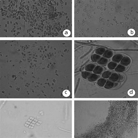Pdf Diversity And Distribution Pattern Analysis Of Cyanobacteria Isolated From Paddy Fields Of