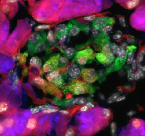 Acinar Derived Insulin Produci Image Eurekalert Science News Releases