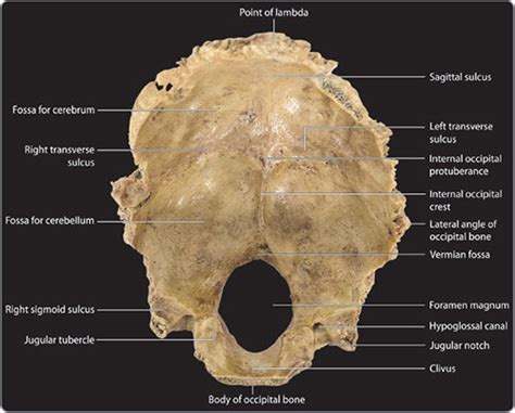 Sigmoid Sulcus