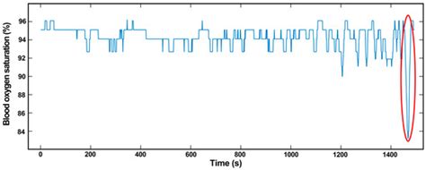Machine Learning Assisted Wearable Wireless Device For Sleep Apnea Syndrome Diagnosis