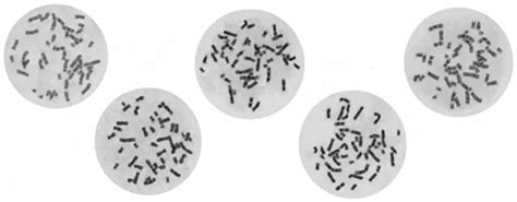 一种细胞悬液的滴片方法与流程