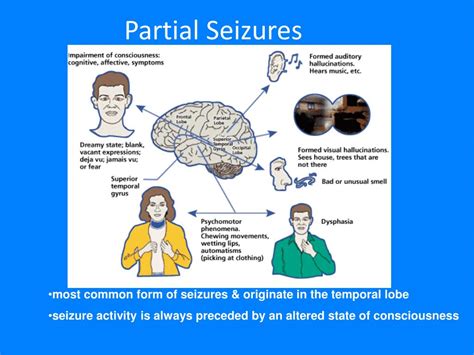 Ppt Epilepsy Powerpoint Presentation Free Download Id5408504