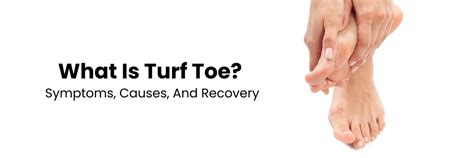 Turf Toe Symptoms Causes And Recovery