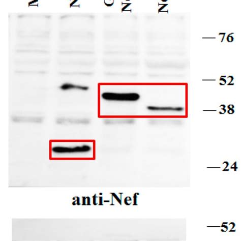 Analysis Of Expression Of Gc Ag Nefmute7 Western Blot Analysis Of