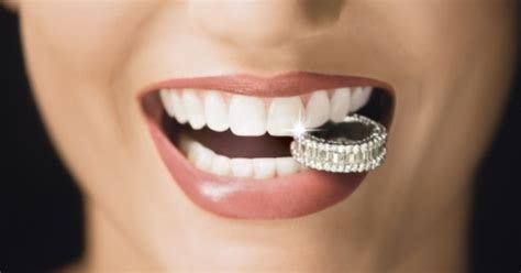 Best Sexy Teeth Images On Pinterest Dental Oral Health And Cigarette Holder