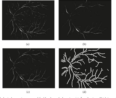 Figure 1 From Automated Detection Of Red Lesions Using Superpixel