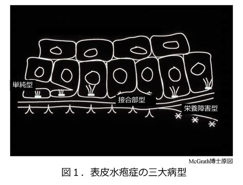 表皮水疱症（指定難病36） 難病情報センター