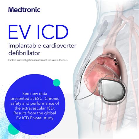 Implantable Cardioverter Defibrillator Medtronic