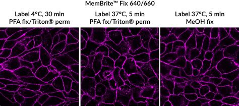 Membrite® Fix Cell Surface Staining Kits Biotium