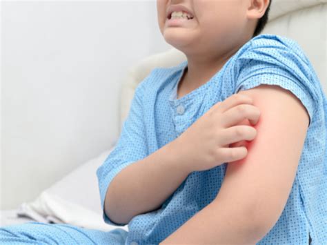 Itchy Skin Try These 5 Effective Natural Remedies Elite Hydration Iv
