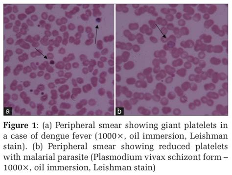 Thrombocyte Histology