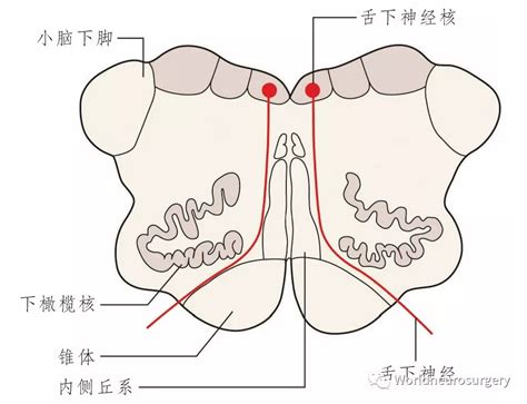 皮质延髓束 皮质核束 皮质脊髓束 大山谷图库