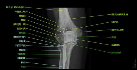 肩、手臂、前臂、手腕、手和和手指x光解剖图 带别针 E Anatomy