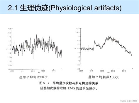 脑电信号的预处理及数据分析要点 Eeg Processing And Feature 3脑电信号预处理在线 Csdn博客