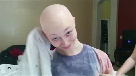 Shaving My Head Alopecia Youtube