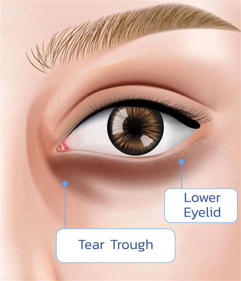 Tear Groove Filler Is An Age Defying Wrinkle Remover Making The Face